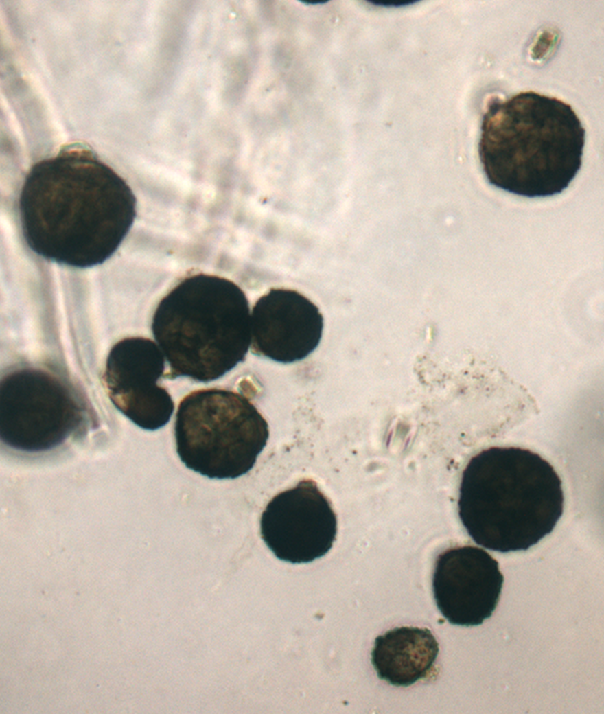 plant pathology 631 lab report: Lab 5 Mitosporic fungi survey