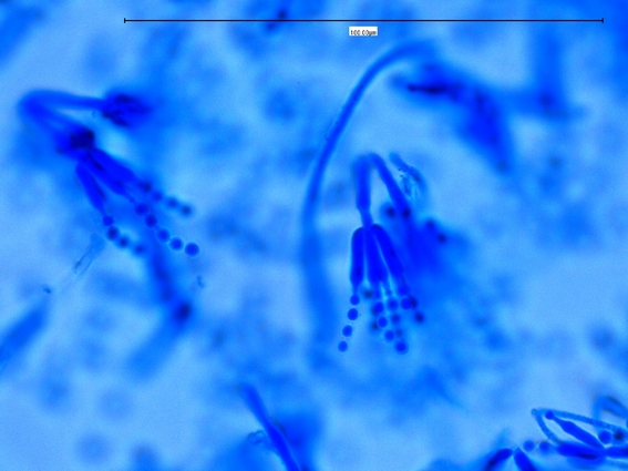 Fun With Microbiology (What's Buggin' You?): Penicillium citrinum