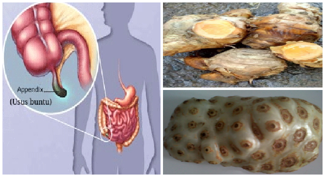 INILAH Obat Tradisional yang Terbukti Ampuh Untuk Mengobati Usus Buntu ...