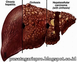 Penjelasan Mengenai Liver ~ Pusat AgaricPro