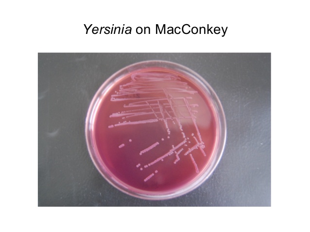 Yersinia (Yersinia enterocolitica,Yersinia pestis) - Microbiology ...