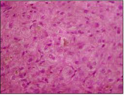 VALORACIÓN CLÍNICA Y METABÓLICA: PATOLOGÍAS DEL HÍGADO