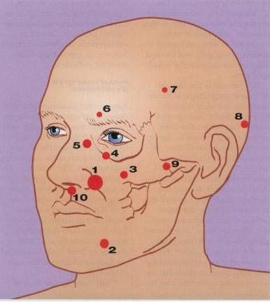 Atypical odontalgia - phantom tooth pain - Bauer Smiles