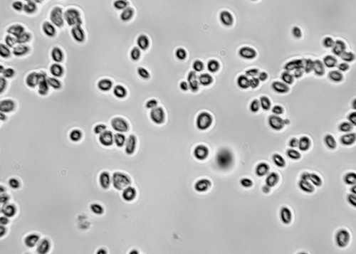 Gambar Jamur Pengertian Ciri Klasifikasi Reproduksi Peranan ...