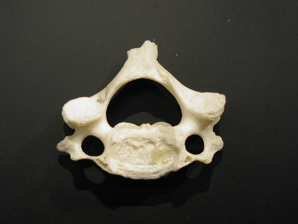 ossos 1