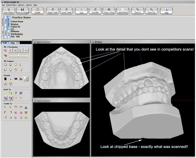 Pediatric Dentistry: 3D Orthodontic Scanner