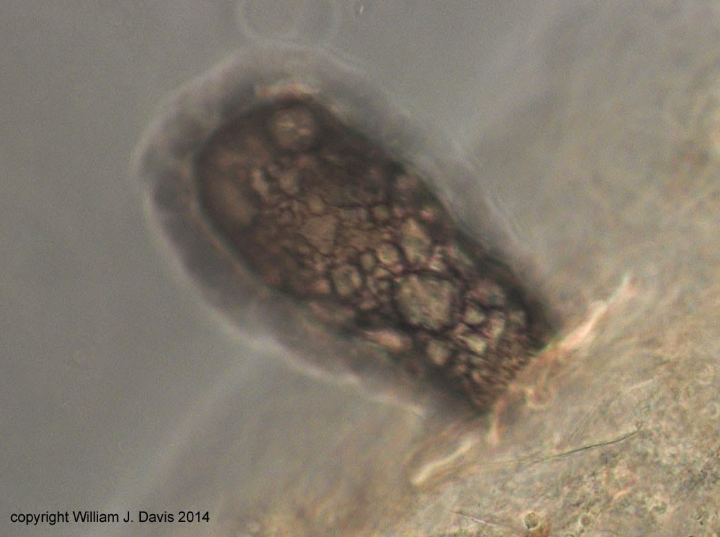 Wandering Naturalist: Protist Love 1--Difflugia!