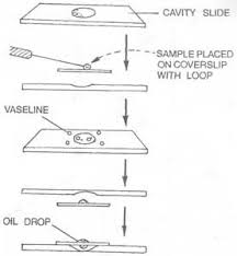 SENTHIL PRABHU SIVASAMY: Hanging Drop Method (Motility Determination)