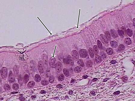 Atlas Histologia Animal: Órgão: Traquéia (mucosa) 40x