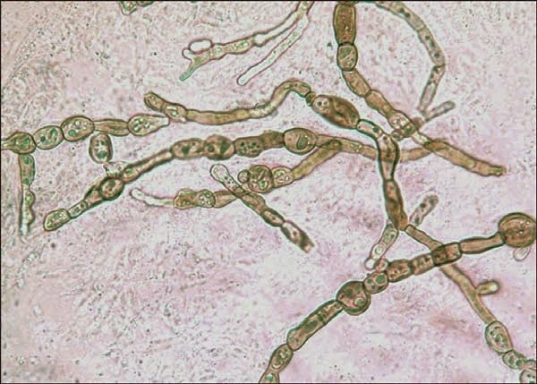 Staining Procedure for Rapid Identification of Fungi | Tuyenlab