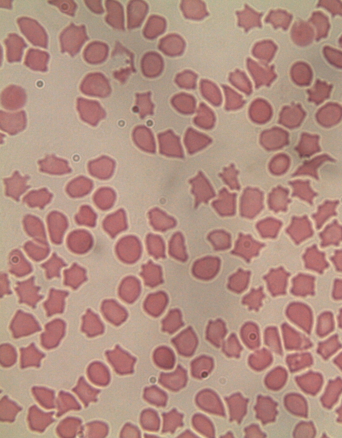 Sangre | Histología Veterinaria Universidad de Antioquia