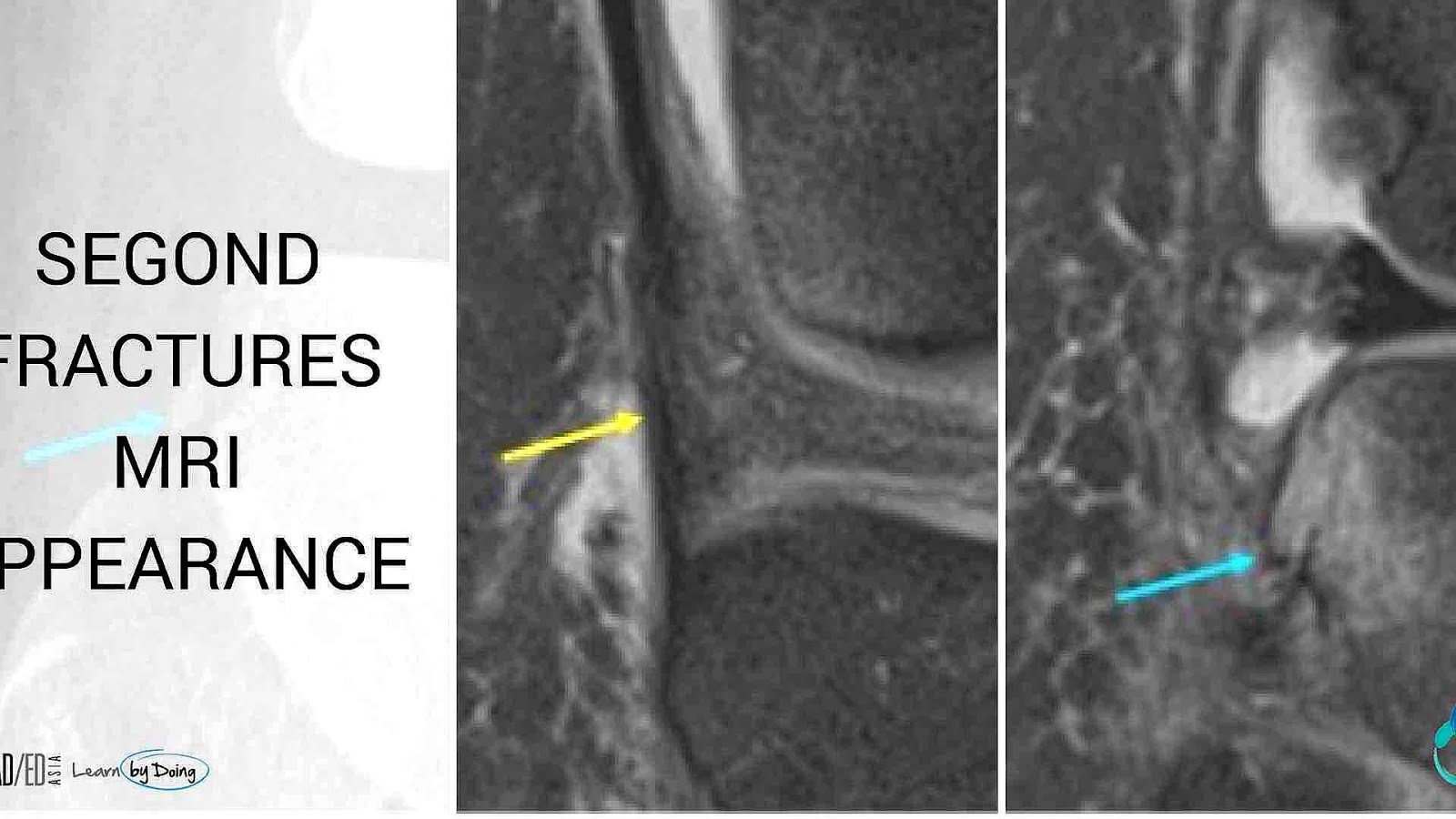 Radiographer - Mri Radiographer Education - Radio Choices
