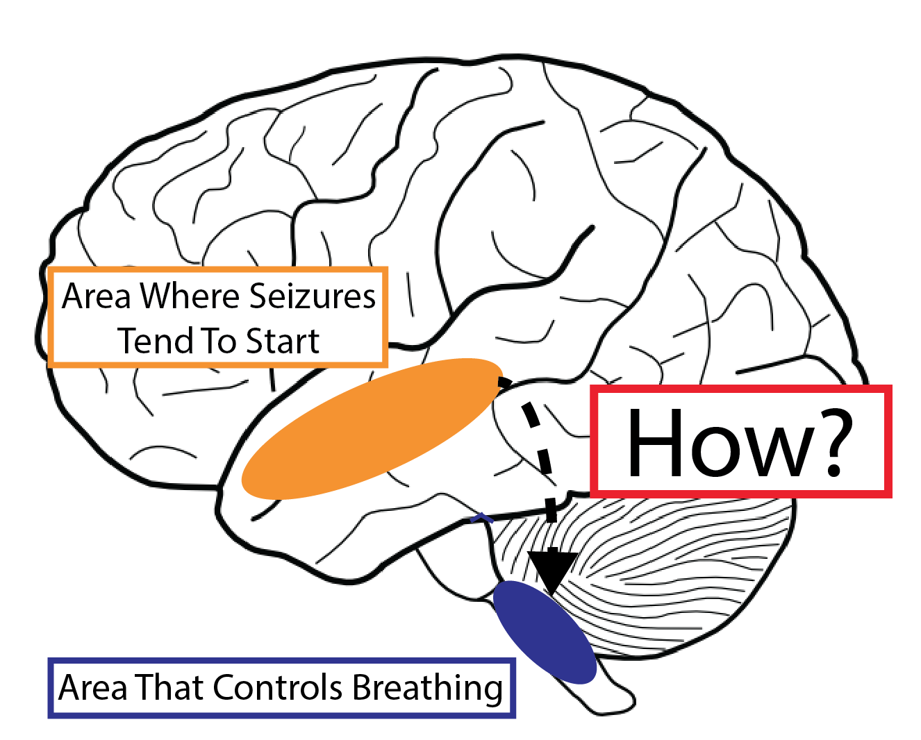Torben's Technologically Outdated Blog: Sniffing and Epilepsy...Why?