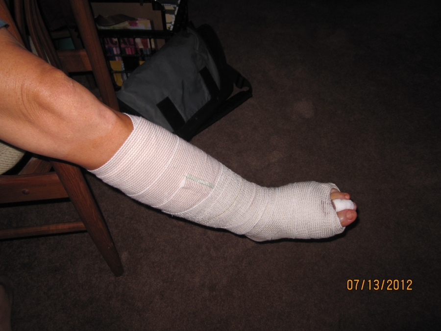 Voyage of S/V Sea Biscuit: Bunion update