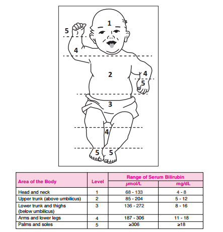 Traumagency: Management Of NNJ 2015