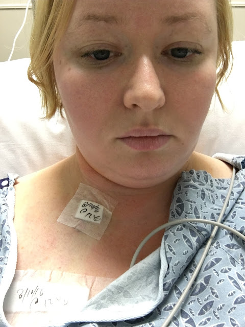 90-Day Life Challenge: My Medical Port - What Happened And Why I Should ...