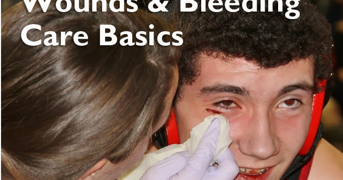 Sports Health: Wound and Bleeding Care Basics PLUS What to Buy for Your ...
