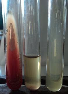 Identifikasi Bakteri Gram Positif dan Gram Negatif ~ Analis Kesehatan ...