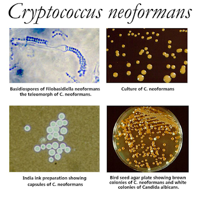 Department Of Microbiology: Cryptococcus neoformans