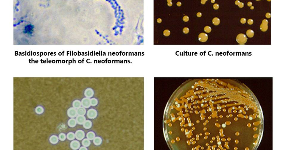 Department Of Microbiology: Cryptococcus neoformans