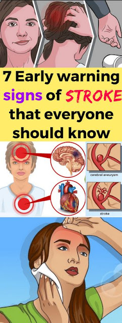 7 Early warning signs of stroke that everyone should know - Lizy Style