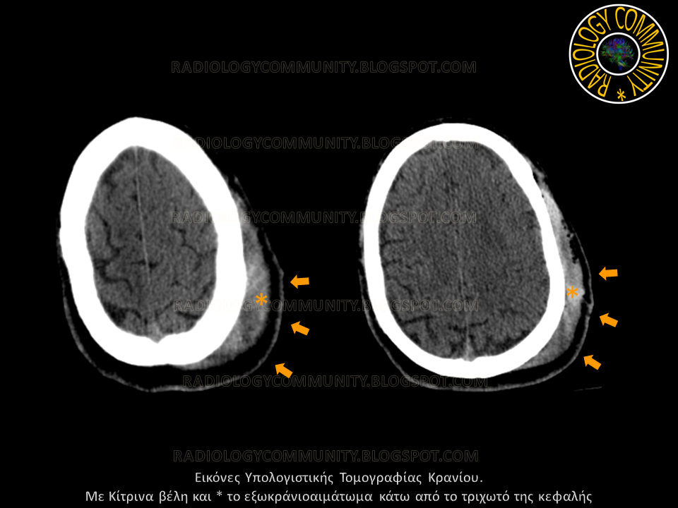 Radiology Community: Απεικονιστικός Έλεγχος πολυτραυματία τροχαίου ...