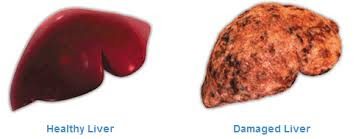 Healthcare and Environments: Main Causes of Liver Damage