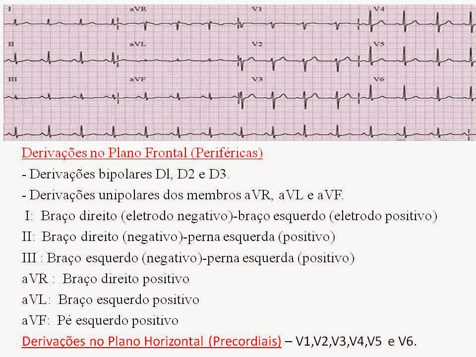 Derivações Ecg D1 D2 D3 - RETOEDU