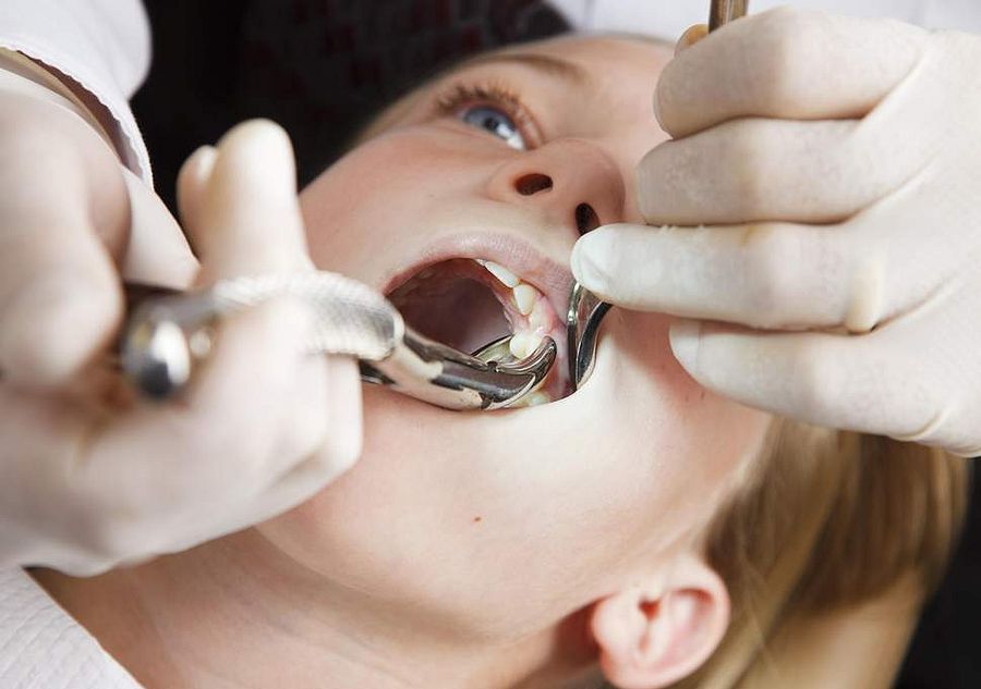 DENTAL NEWS: A child in England has a rotten tooth removed every 10 minutes