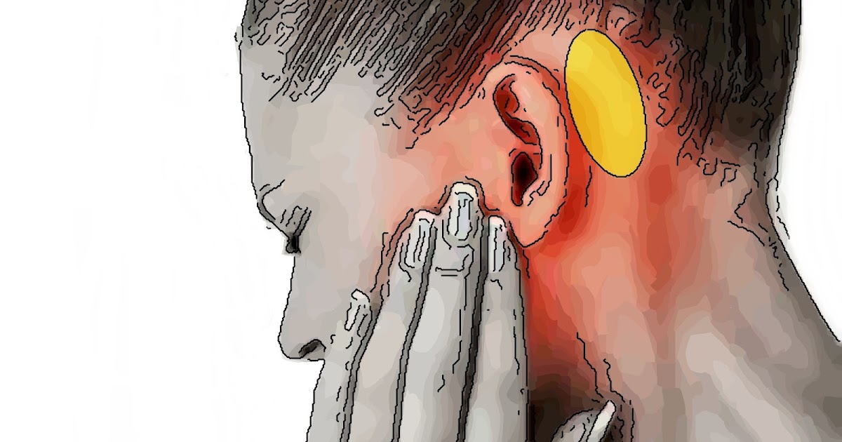 Mastoidit Tanımı, Nedenleri, Belirtileri ve Tedavisi