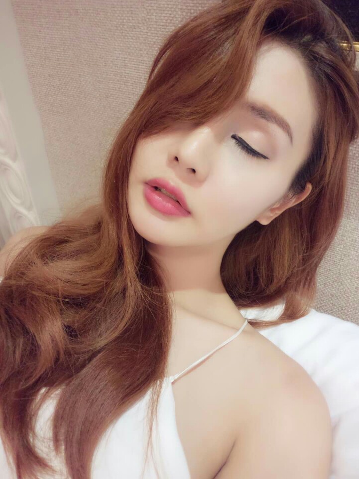 TL PLASTIC SURGERY CLINIC KOREA: No more flat&sunken forehead!! TL ...