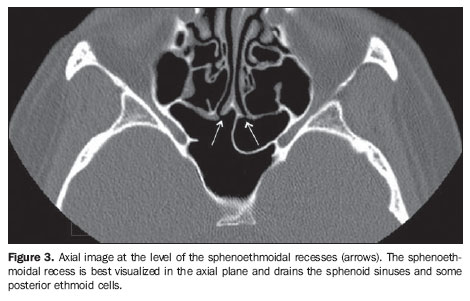 Auger Gear Image: Agger Nasi Cell Ct