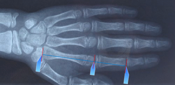 Science Mystery: Interesting Facts About The Golden Ratio | Elixir Of ...