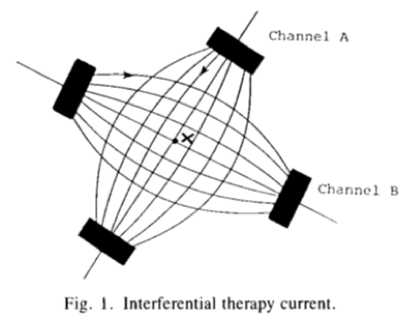 Interferential Therapy for Stress Incontinence: Part 2: Interferential ...