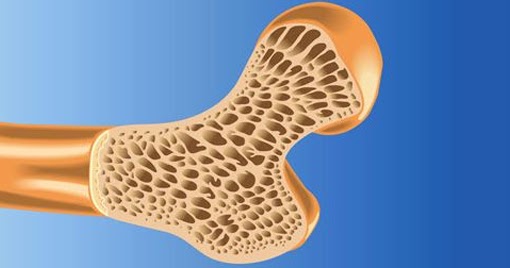 El Blog de Yuan: DIARIO DE UN HUESO SANO - RECOMENDACIONES PARA ...