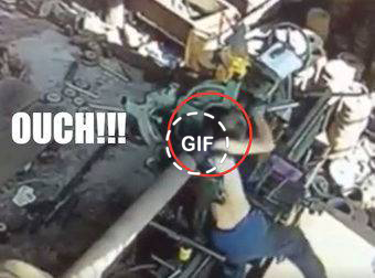 He Was Violently Caught In An Industrial Machine, But Somehow Finds A ...