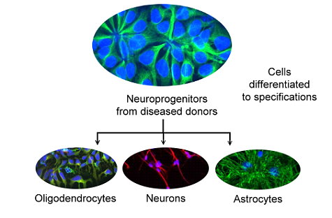 Neuromics: Cells from Diseased Donors