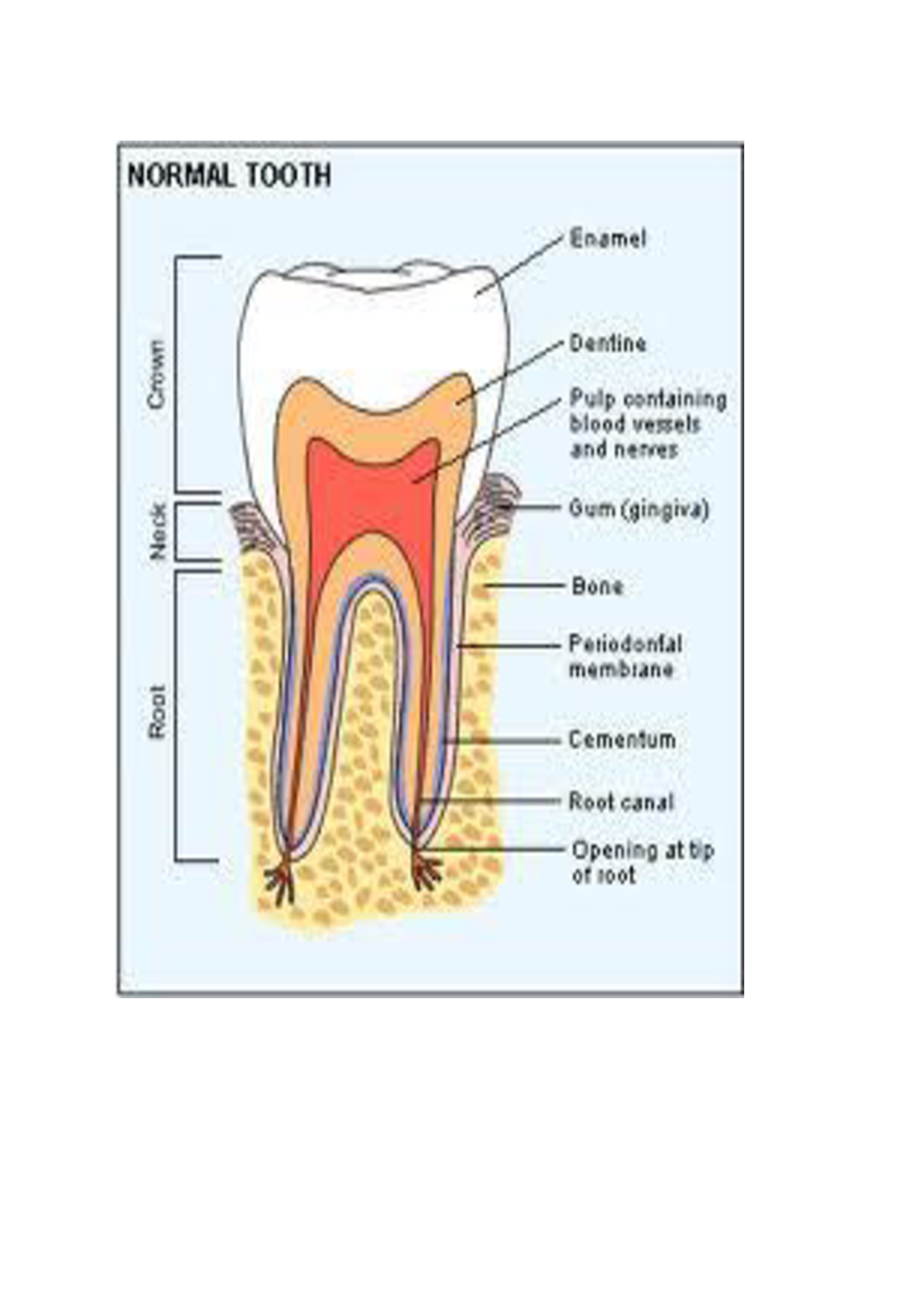 Cure for tooth cavities