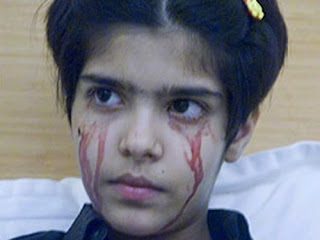 Deformutilation: The Girl Who Cries Blood