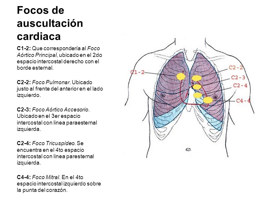 Neo médico : Focos de auscultación cardíaca.
