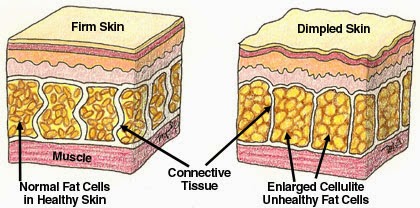 vitamin organik: KAEDAH MEMBUANG SELULIT DENGAN MUDAH