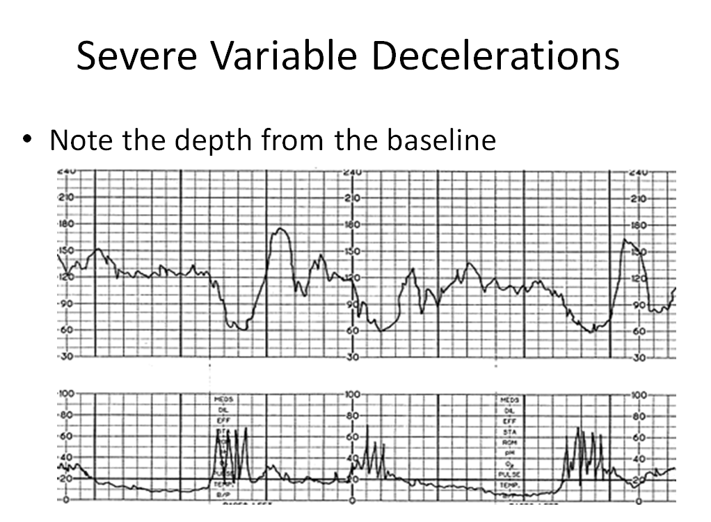 MBBS Medicine (Humanity First): Assessment of Fetal Well-being
