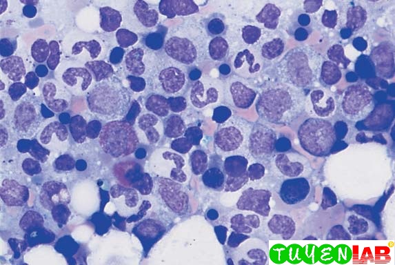 [Haematology] Normal Cells of the Blood and Hematopoietic Organs | Free ...