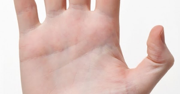 Hypothenar Hammer Syndrome Definition, Symptoms, Causes, Treatment ...