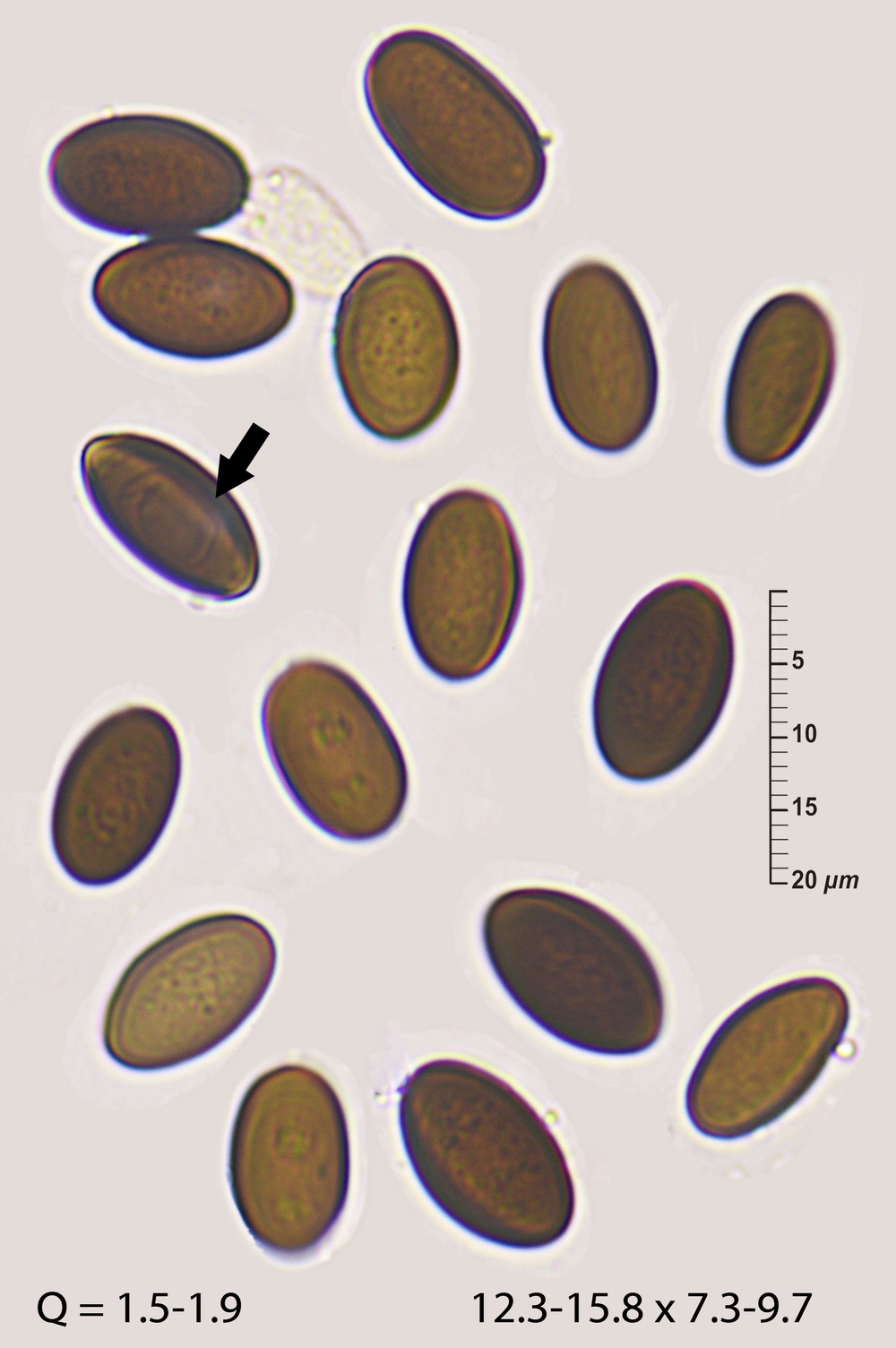 Coniochaeta alkalivirens Checa & G. Moreno • CEMAS esporas oblongas con ...
