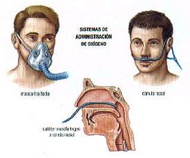 ENFERMERÍA QUIRÚRGICA: “ OXIGENOTERAPIA”