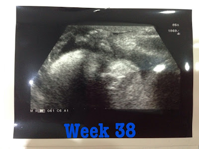 It's All About You Baby: Week 38 and still counting! CTG done on this day.
