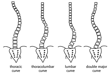 Curvaceous Spine: 2014
