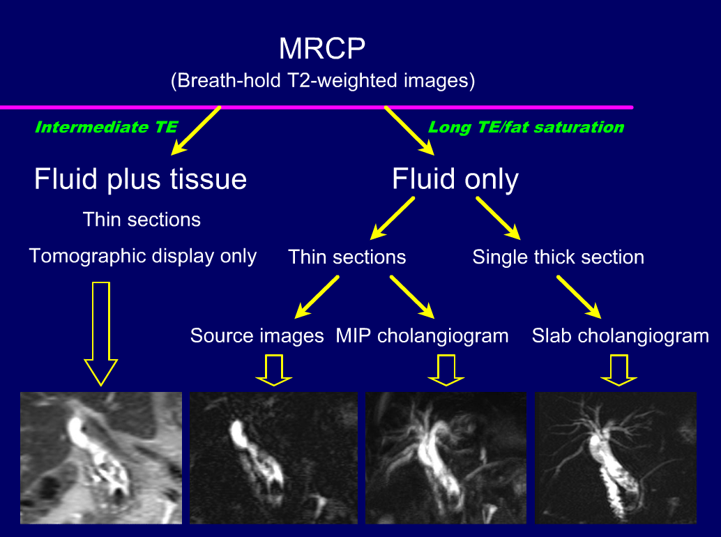 rsna: pancreas imaging