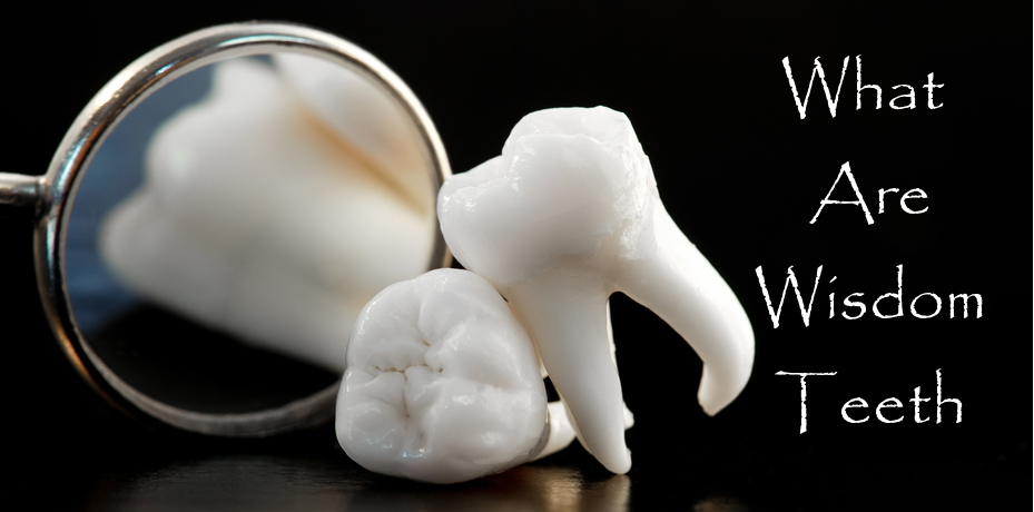 Smile Station: What are Wisdom Teeth?